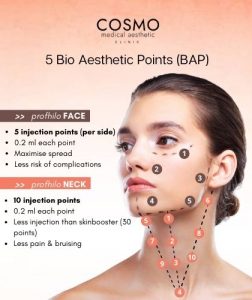 Profhilo: Benefits, Side Effects, and Cost Guide (2025)