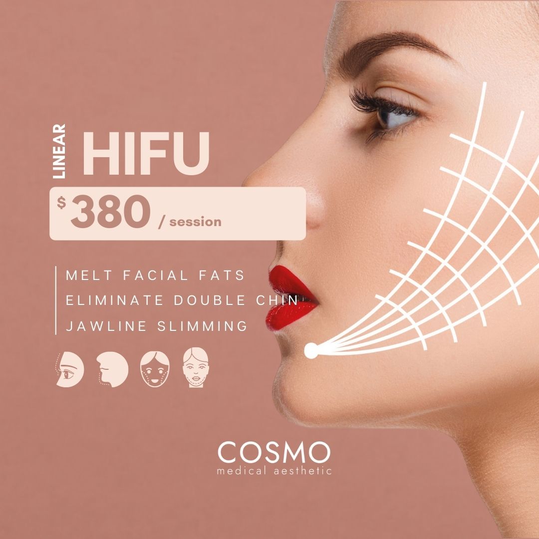 HIFU Price & Review (2023) - Cosmo Aesthetic Clinic Singapore