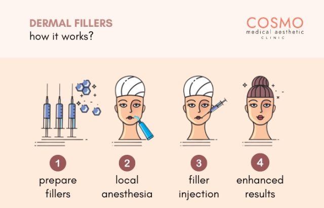 Dermal Fillers: Benefits, Side Effects, and Price Guide (2024)