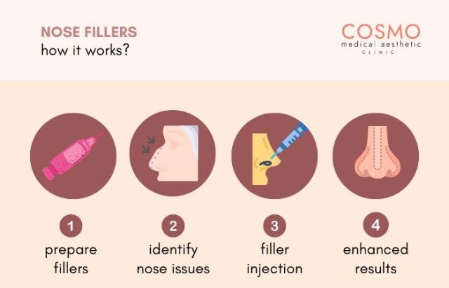 Nose Fillers: Benefits, Side Effects, and Price Guide (2025)