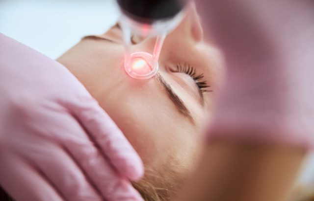 Q Switch Laser: Benefits, Side Effects, and Price Guide (2025)